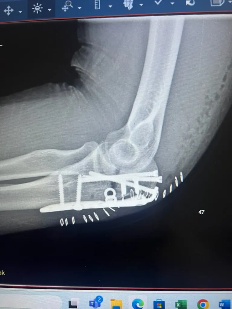 FOTOD Robin Valting paljastab haiglas veedetud aja positiivseid külgi ...
