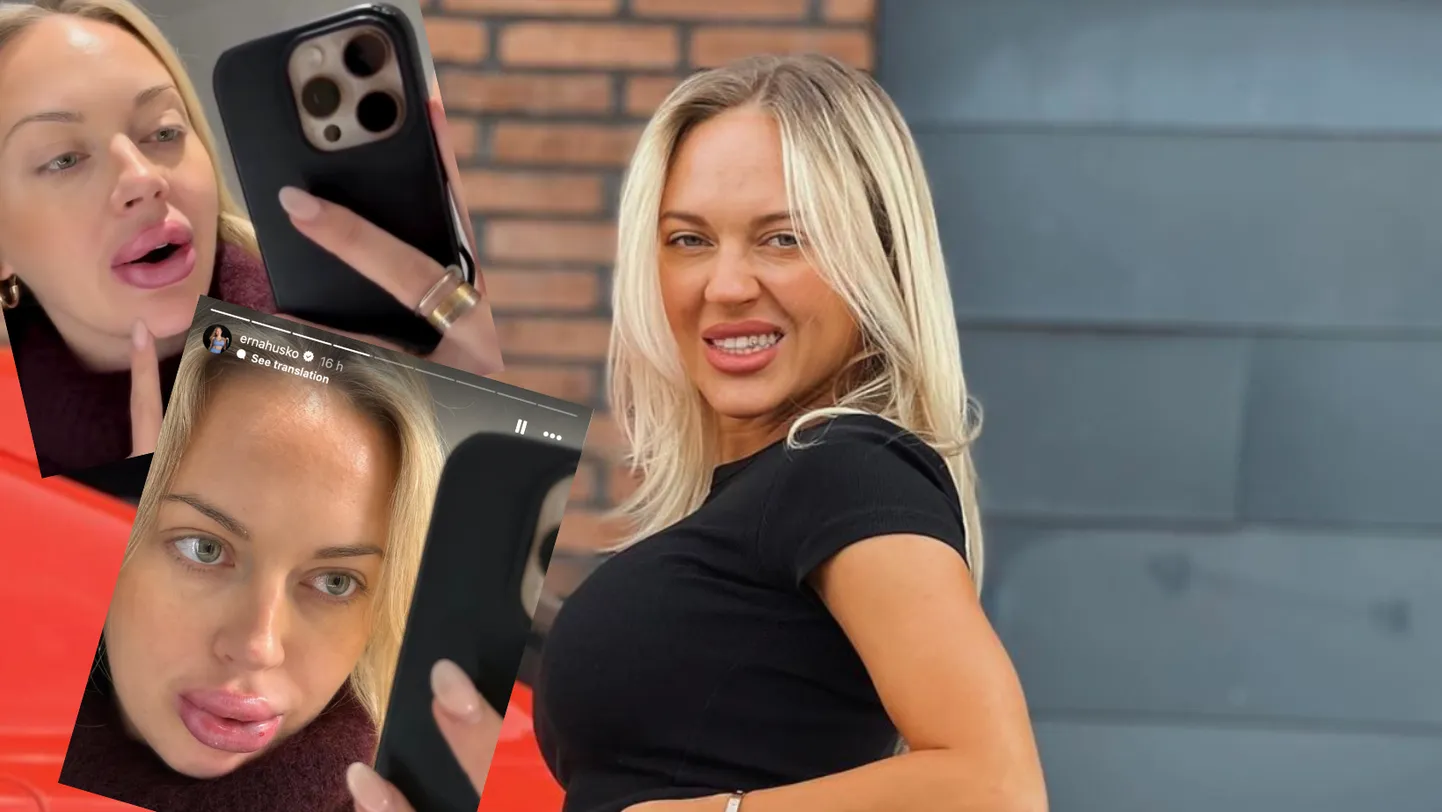 «Saan tagasi oma päris huuled!» Erna Husko iluotsus tõi talle ootamatu ...