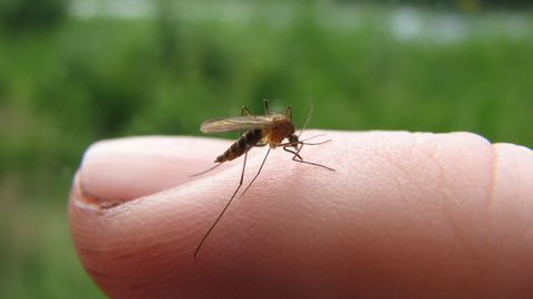 Struuma | Haiguste ABC - Kliinik.ee